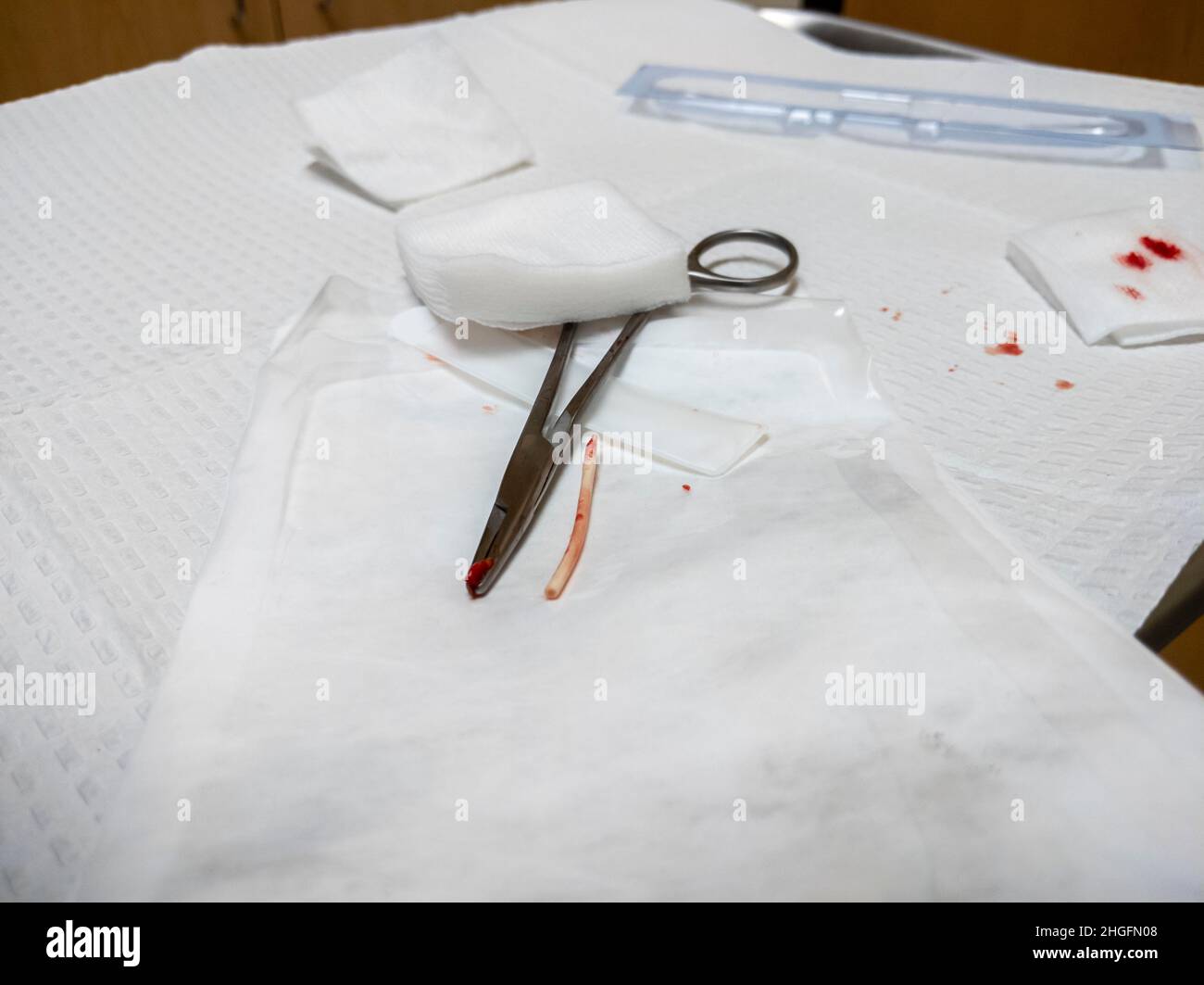 Contraceptive implant arm hi-res stock photography and images - Alamy