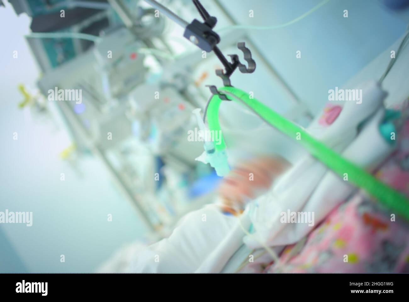 Newborn baby connected to the life support equipment in the NICU Stock ...