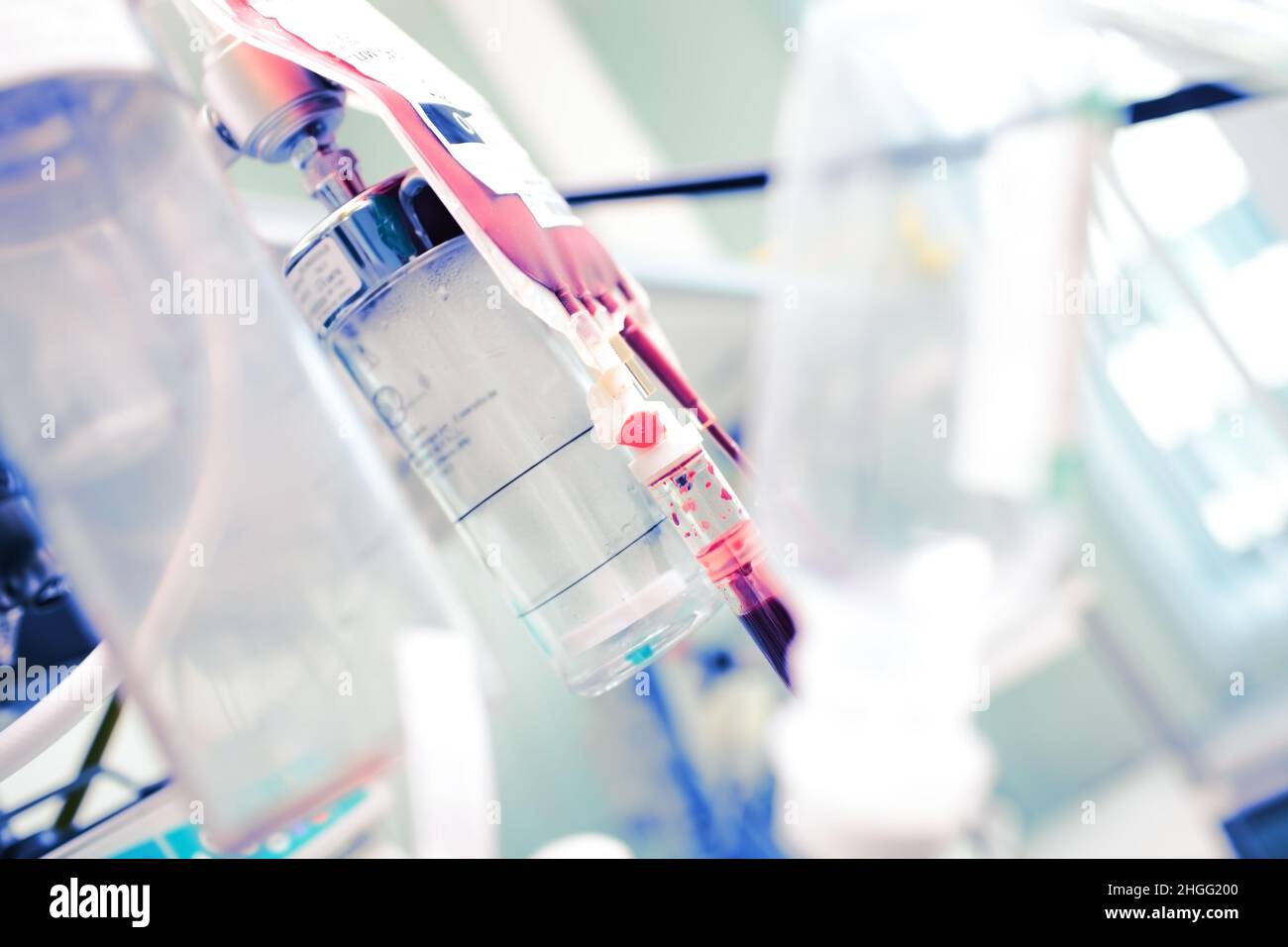 Blood transfusion bag hi-res stock photography and images - Alamy