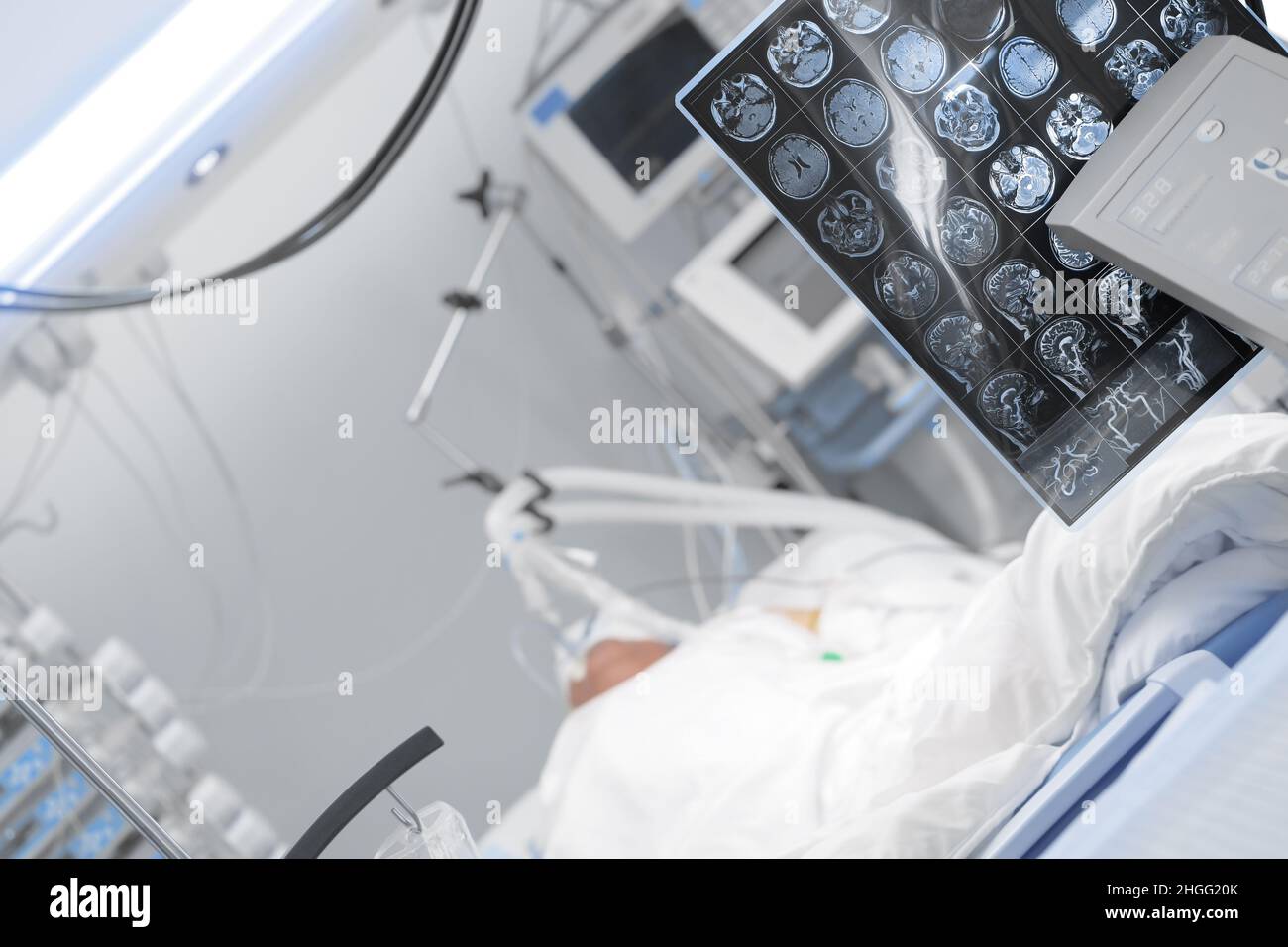 Comatose patient hi-res stock photography and images - Alamy