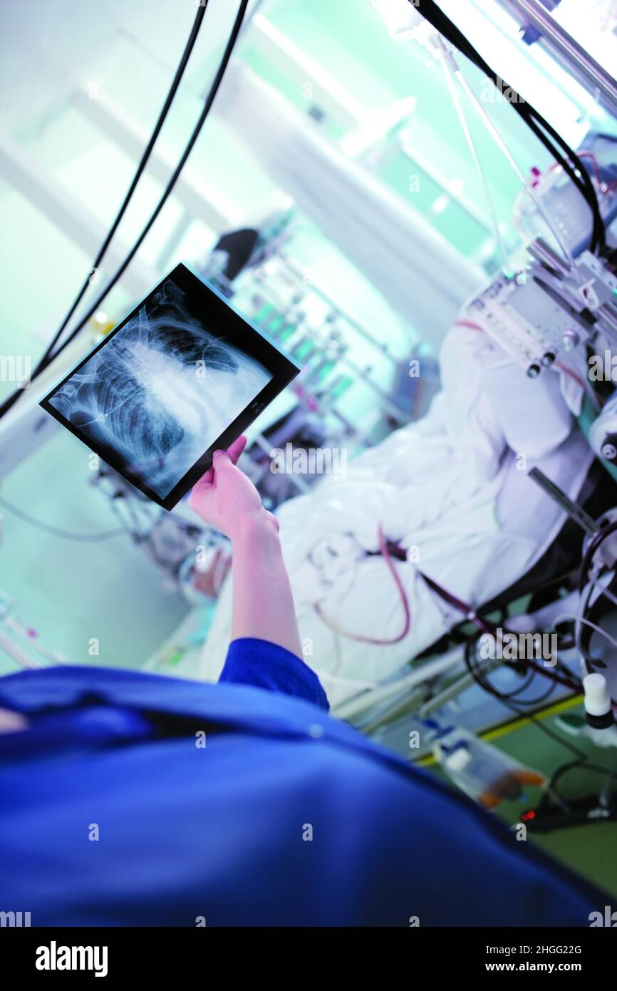 Female health worker holding x-ray film of patient chest in the ...