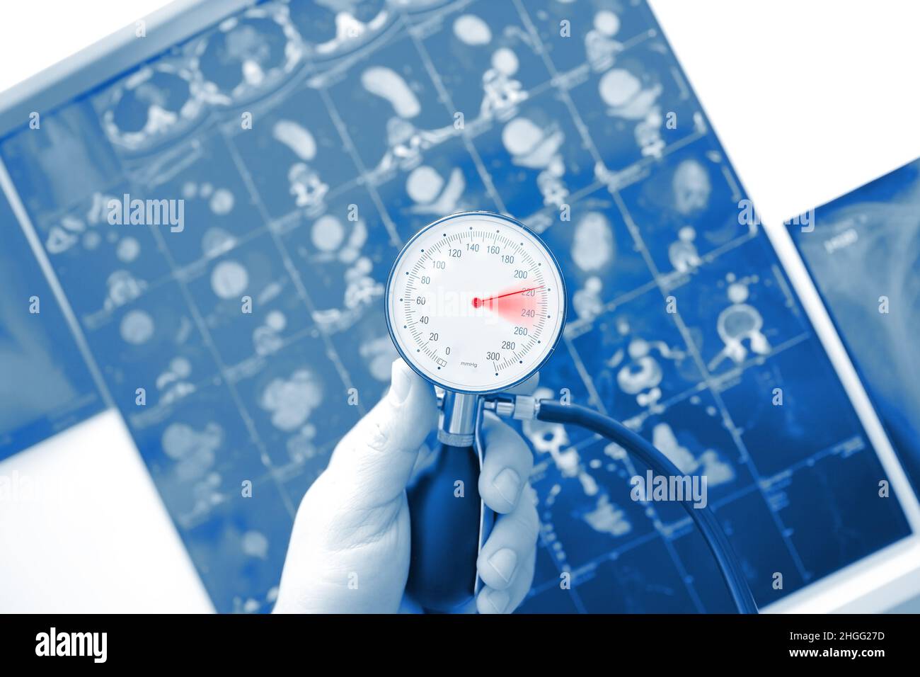 Blood vessel measurement hi-res stock photography and images - Alamy