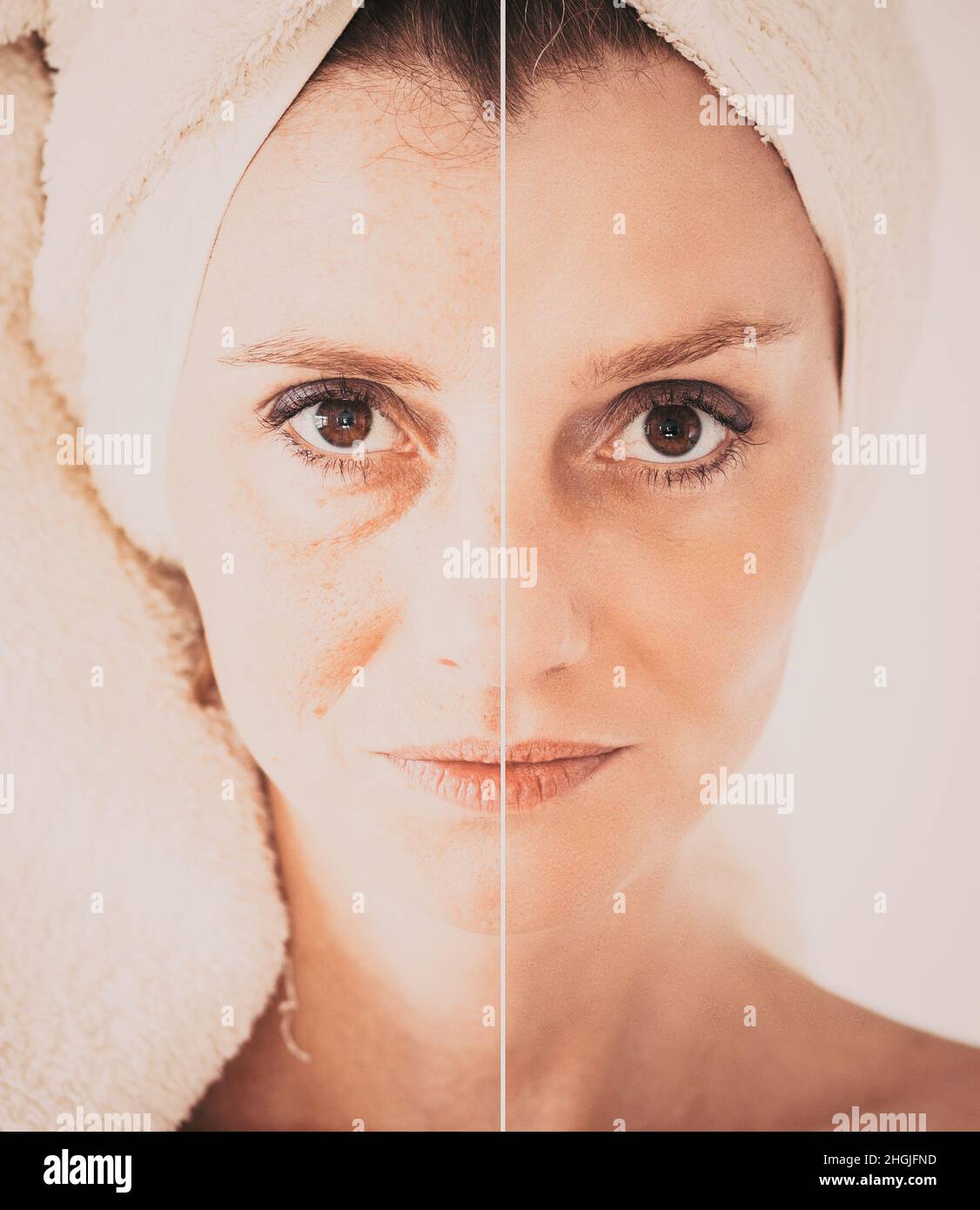 beauty concept - skin care, anti-aging procedures, rejuvenation ...