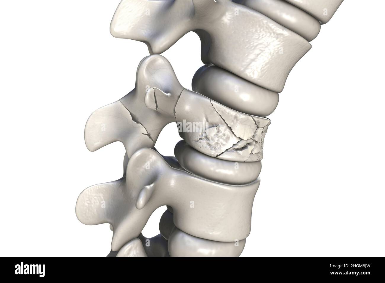 Spinal column anatomical cut out hi-res stock photography and images ...
