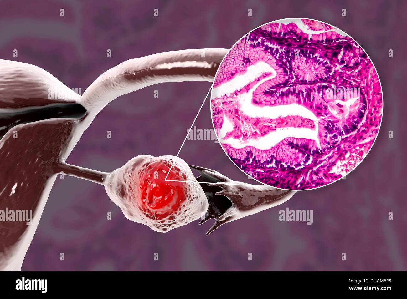 Histology ovary hi-res stock photography and images - Alamy