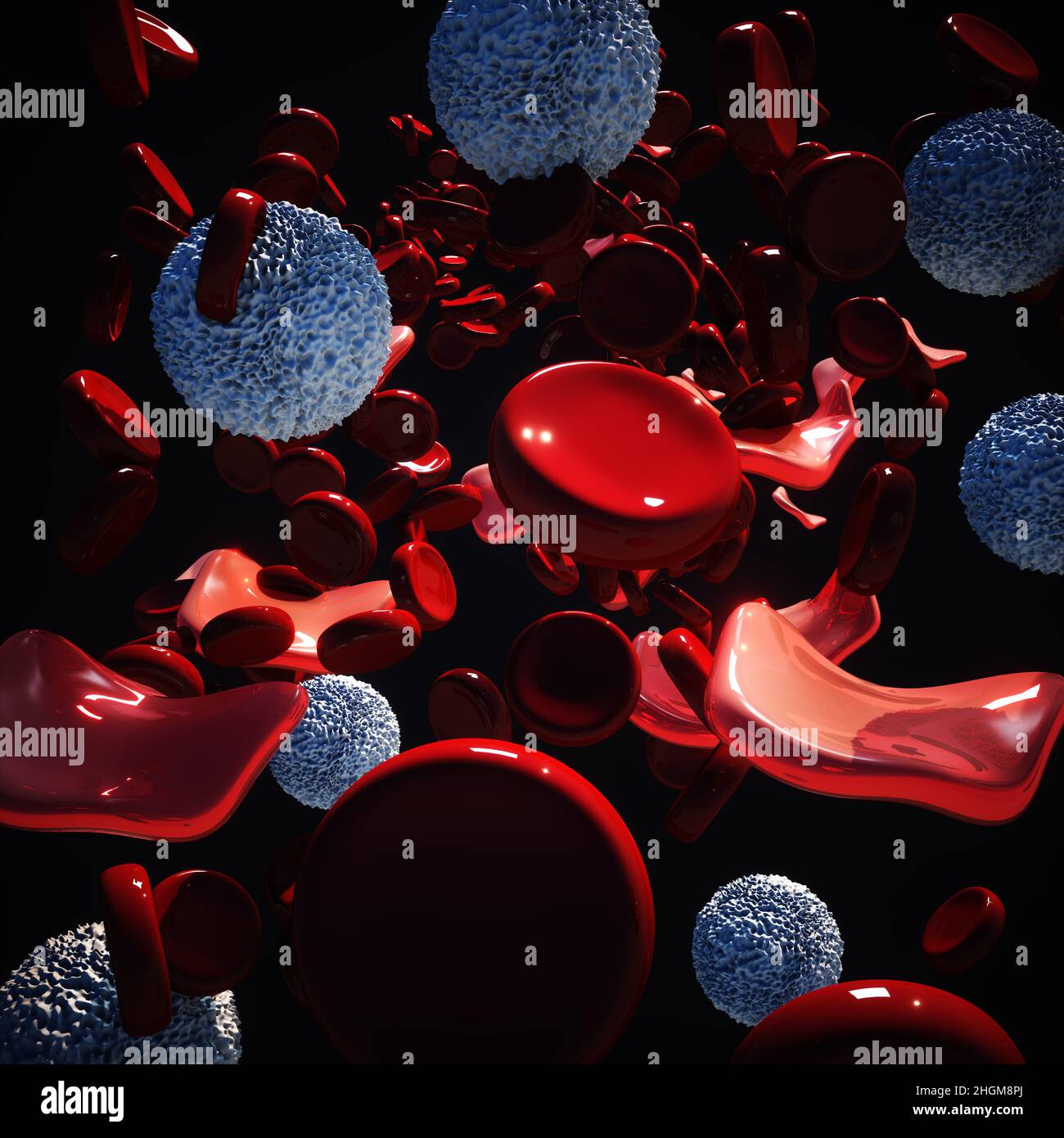 Thalassemia erythrocytes hi-res stock photography and images - Alamy