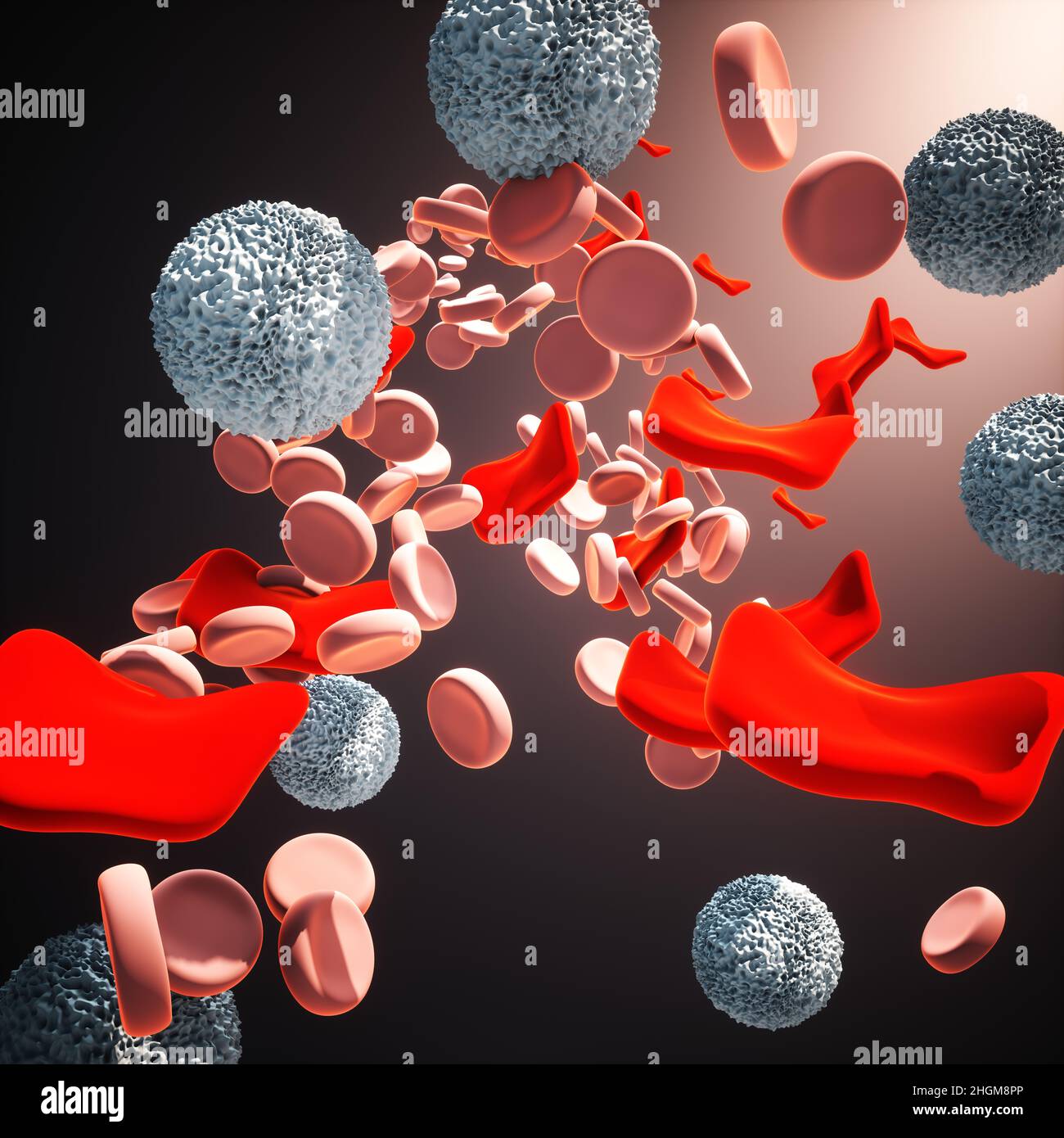 Thalassemia red blood hi-res stock photography and images - Alamy