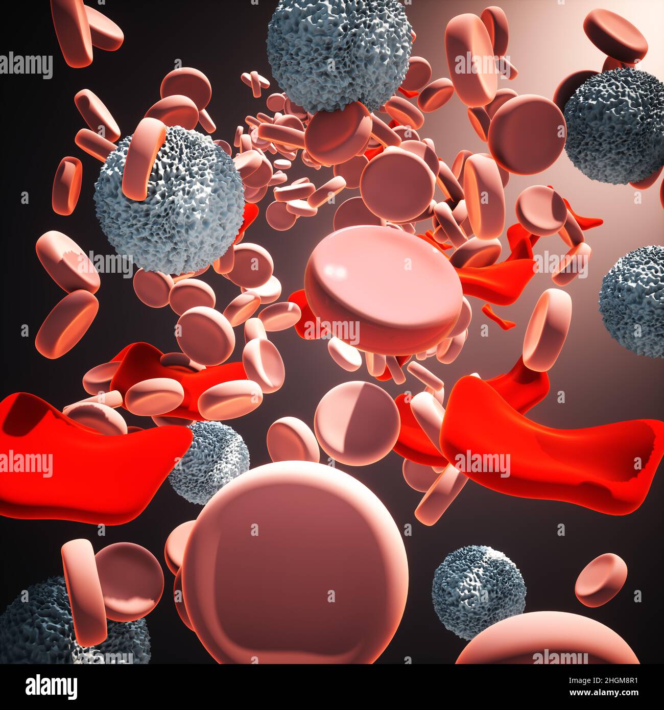 Thalassemia red blood hi-res stock photography and images - Alamy