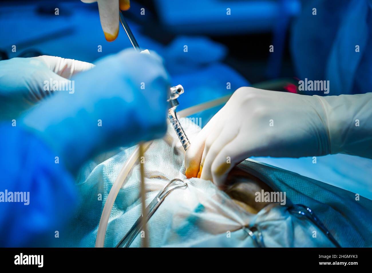 Ovaries Uterus High Resolution Stock Photography and Images - Alamy