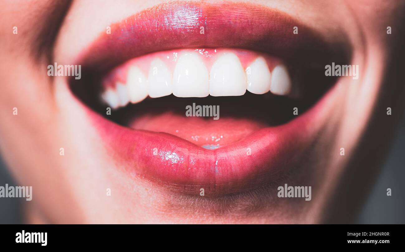 Smile teeth. Laughing woman mouth with great teeth close up. Healthy ...