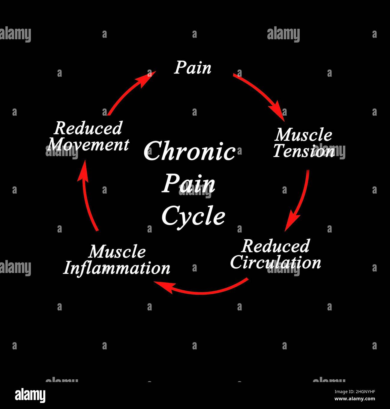 Steps in Chronic Pain Cycle Stock Photo - Alamy
