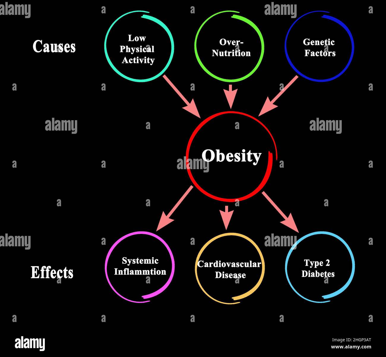 Effects of obesity hi-res stock photography and images - Alamy
