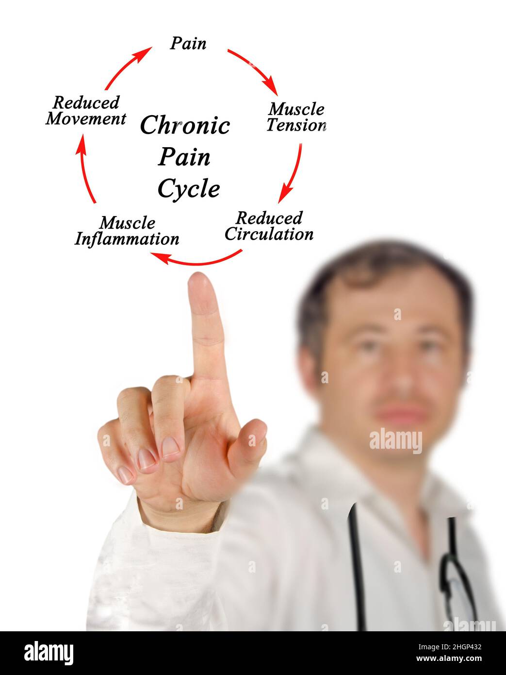 Steps in Chronic Pain Cycle Stock Photo - Alamy