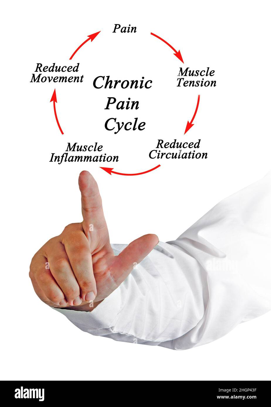 Steps in Chronic Pain Cycle Stock Photo - Alamy