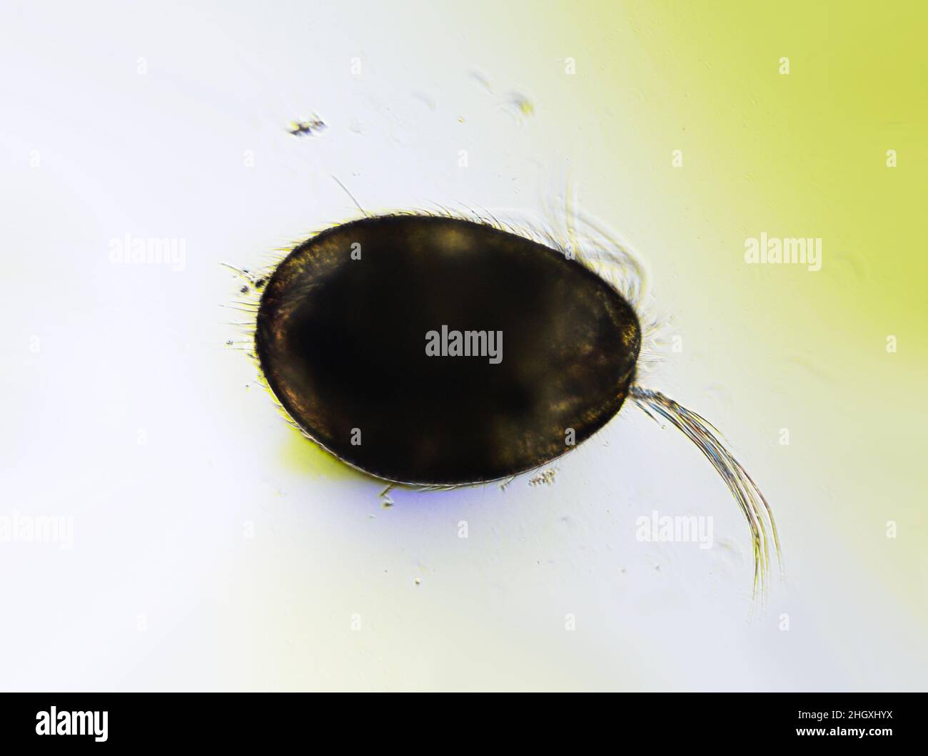 Microscopic freshwater Ostracod aka seed shrimp, taken from a pond of ...
