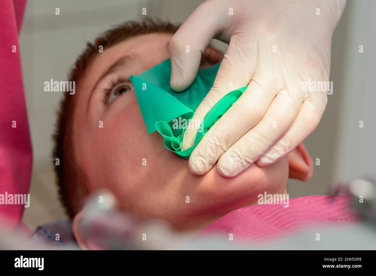 The dentist installs a rubber dam and a clamp for the treatment of a ...
