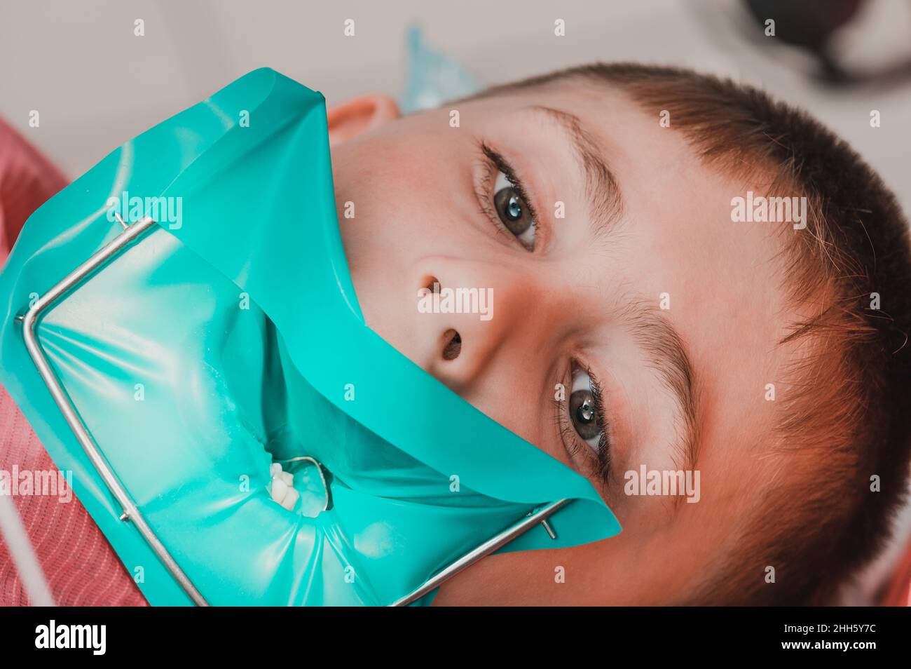The dentist treats the child's tooth using a rubber dam, installing a ...