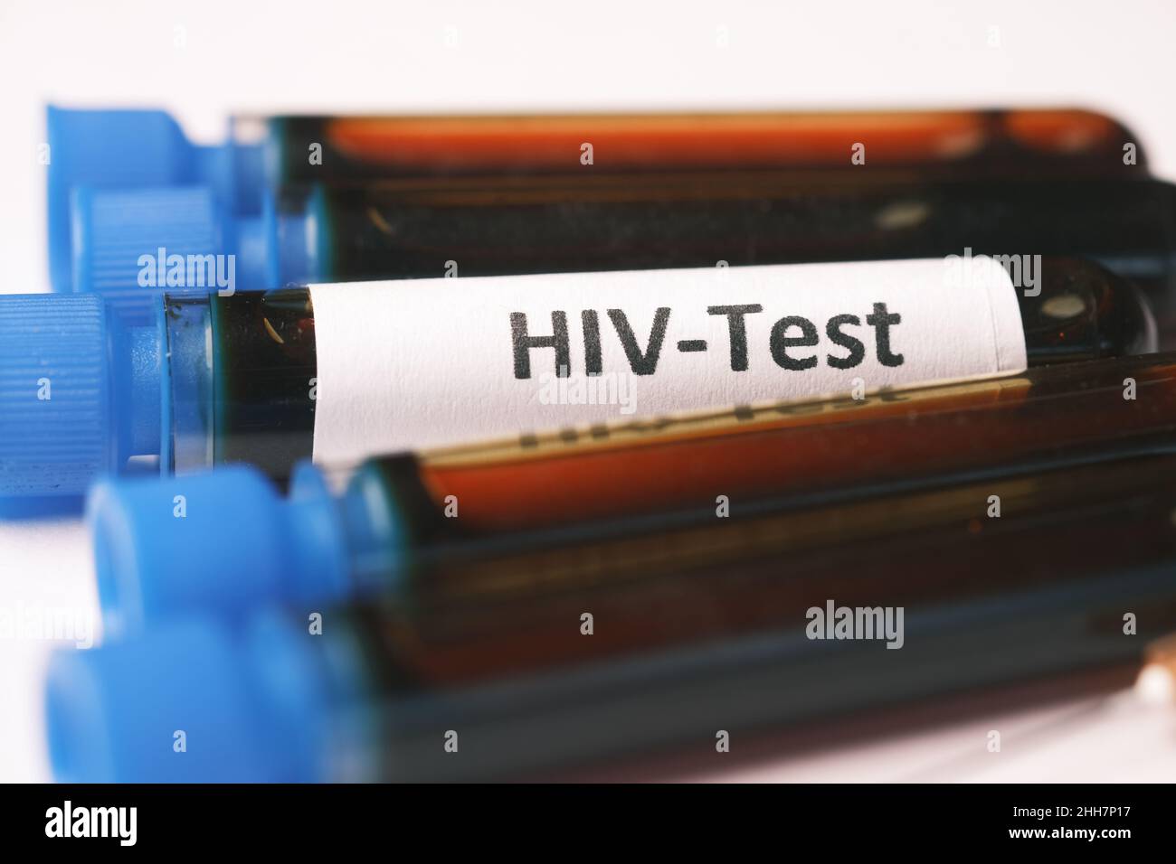 Positive hiv blood test hi-res stock photography and images - Alamy