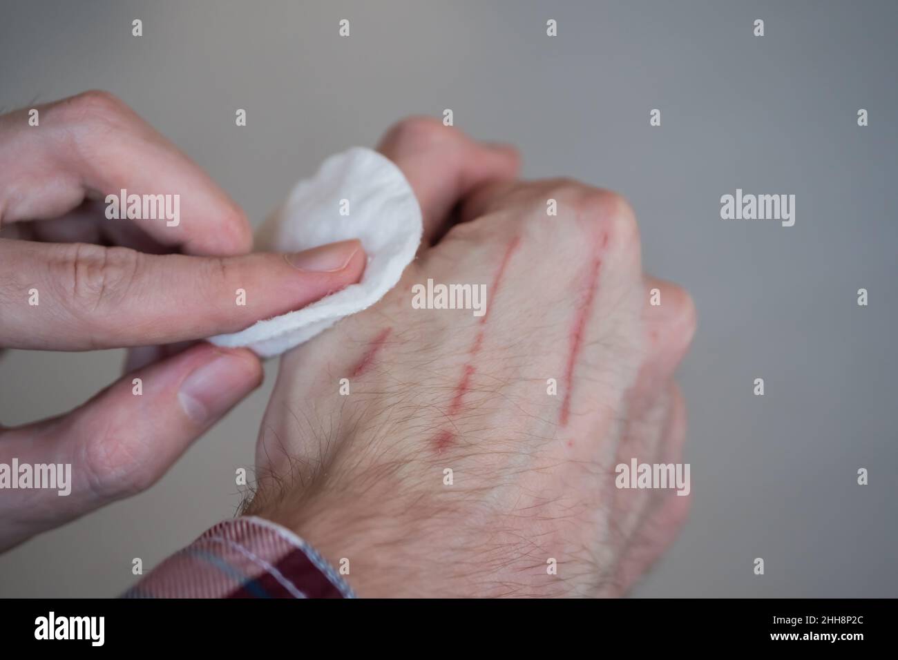 Hydrogen peroxide cut hi-res stock photography and images - Alamy