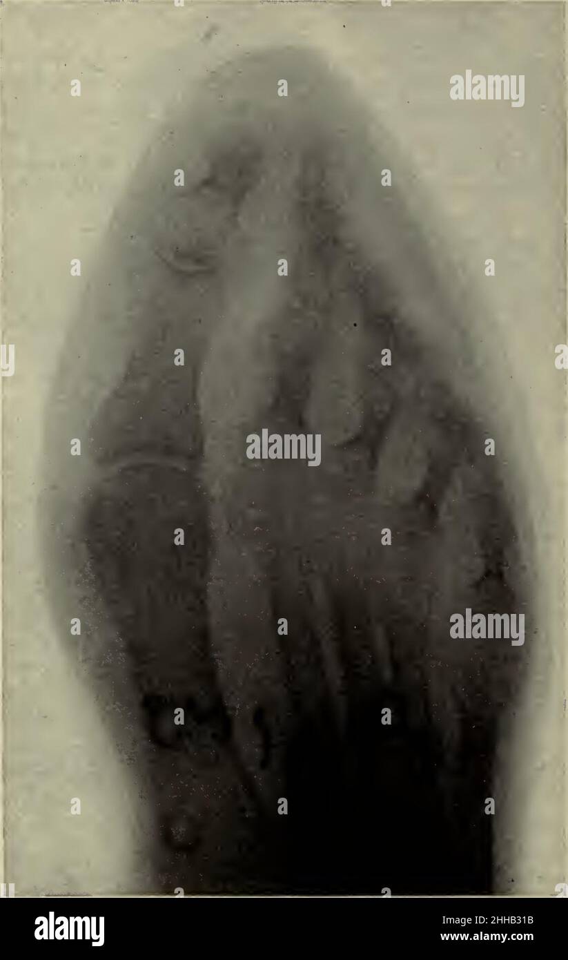 Soldiersfootmili00munsrich Fig27 Foot of a soldier wearing a popular ...