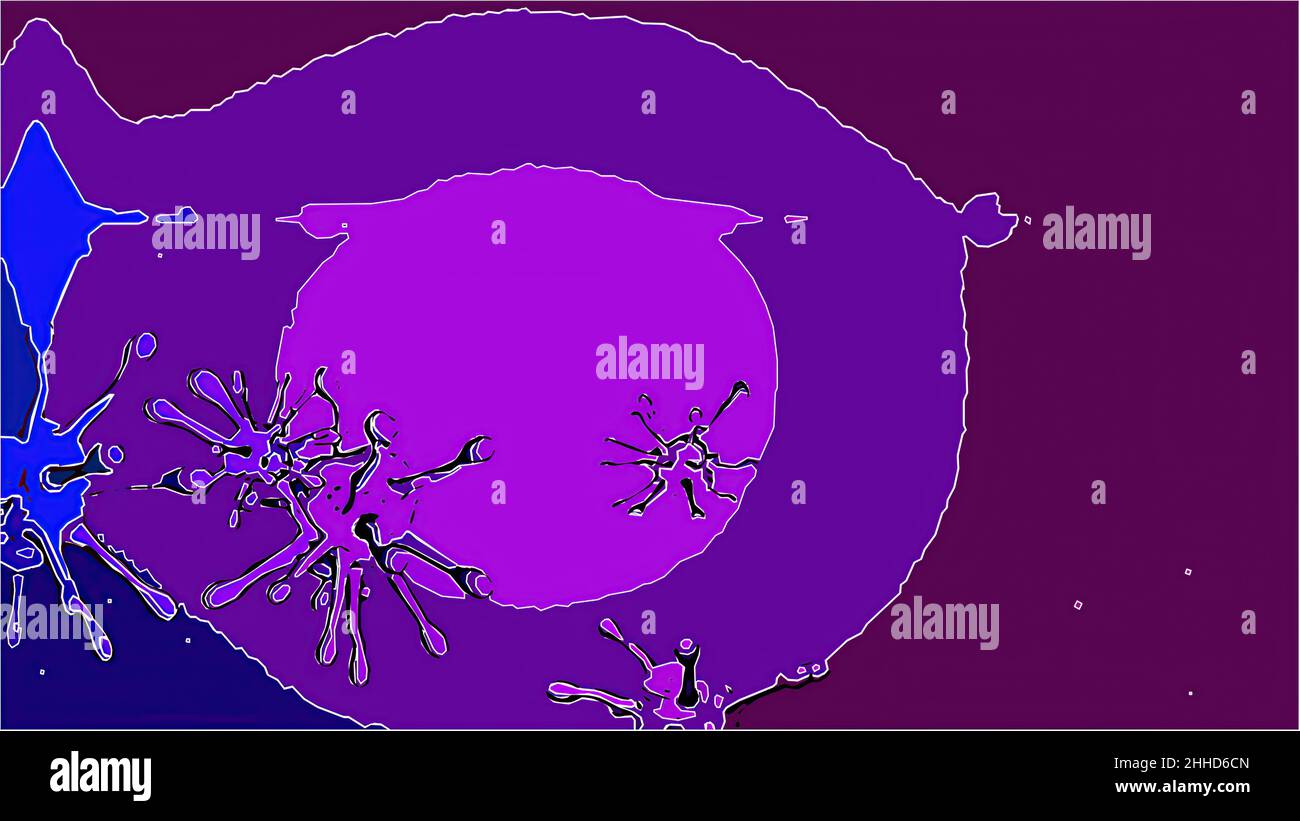 3d illustration in comic style - Concept of Cancer Cell in human body ...