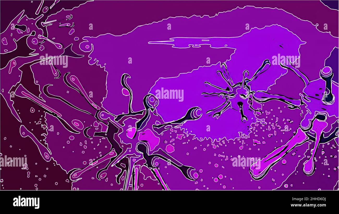 3d illustration in comic style - Concept of Cancer Cell in human body ...