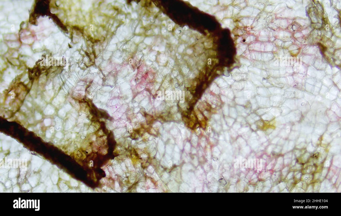 Potato under the microscope Stock Photo - Alamy