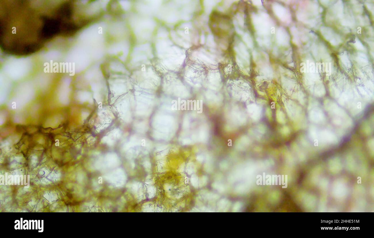 Potato under the microscope Stock Photo - Alamy