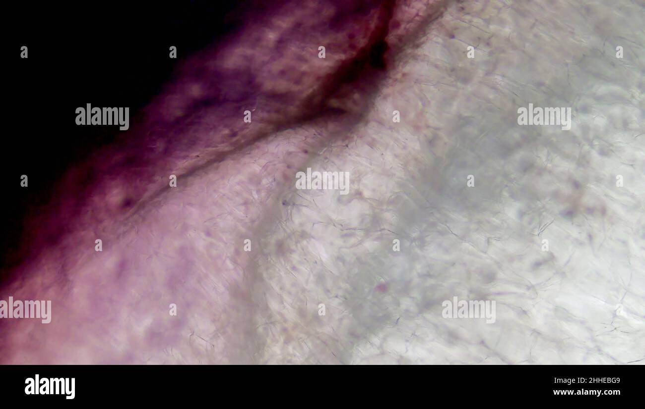 Red grape under the microscope Stock Photo - Alamy