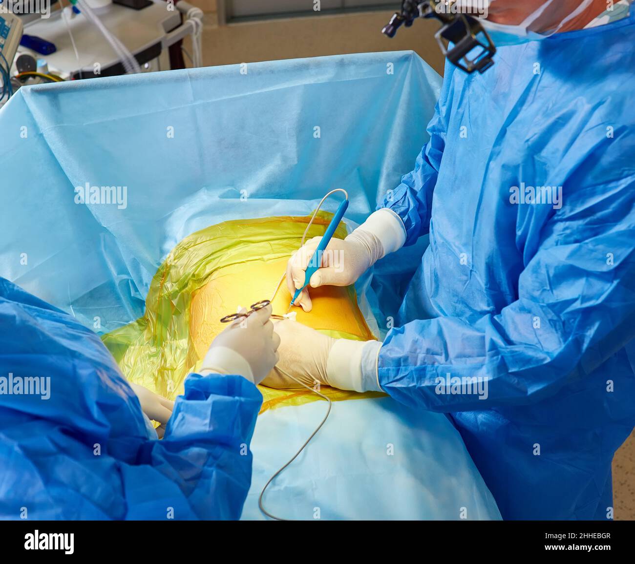 Oxygen in operating theatre hi-res stock photography and images - Alamy
