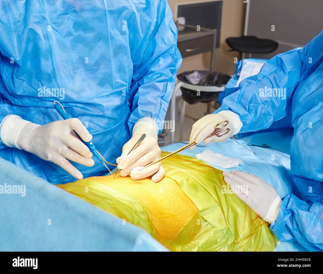 Side view of three surgeons at work in the operating theatre Stock ...