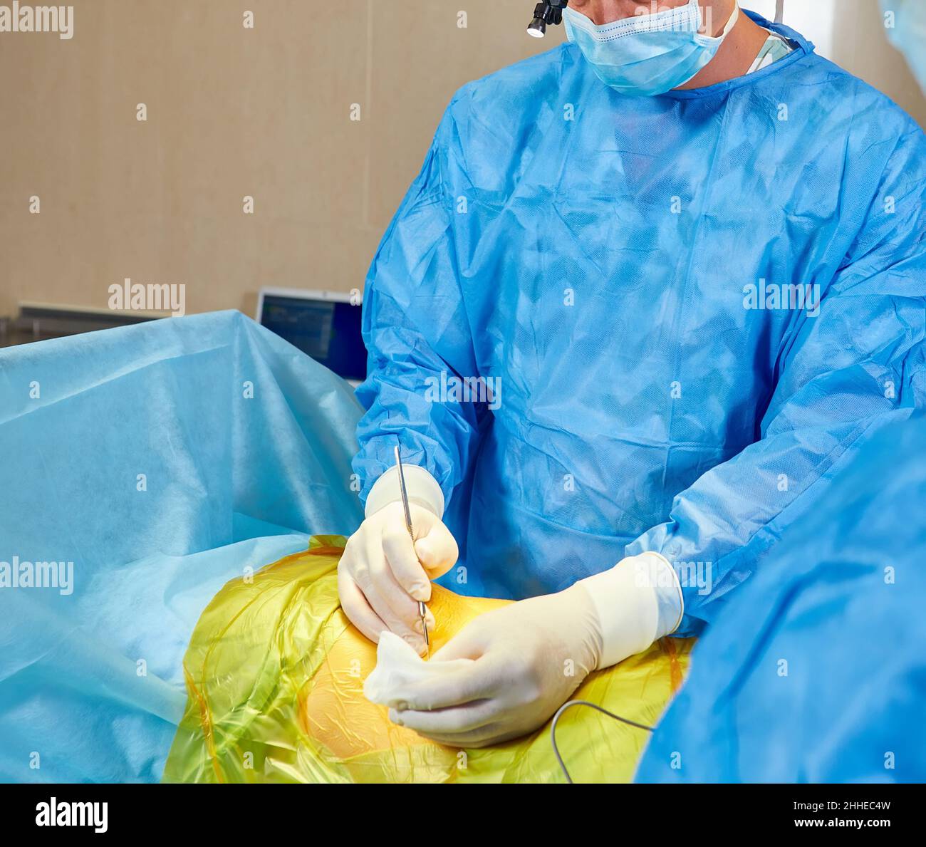 Hospital blood surgery surgeons theatre hi-res stock photography and ...