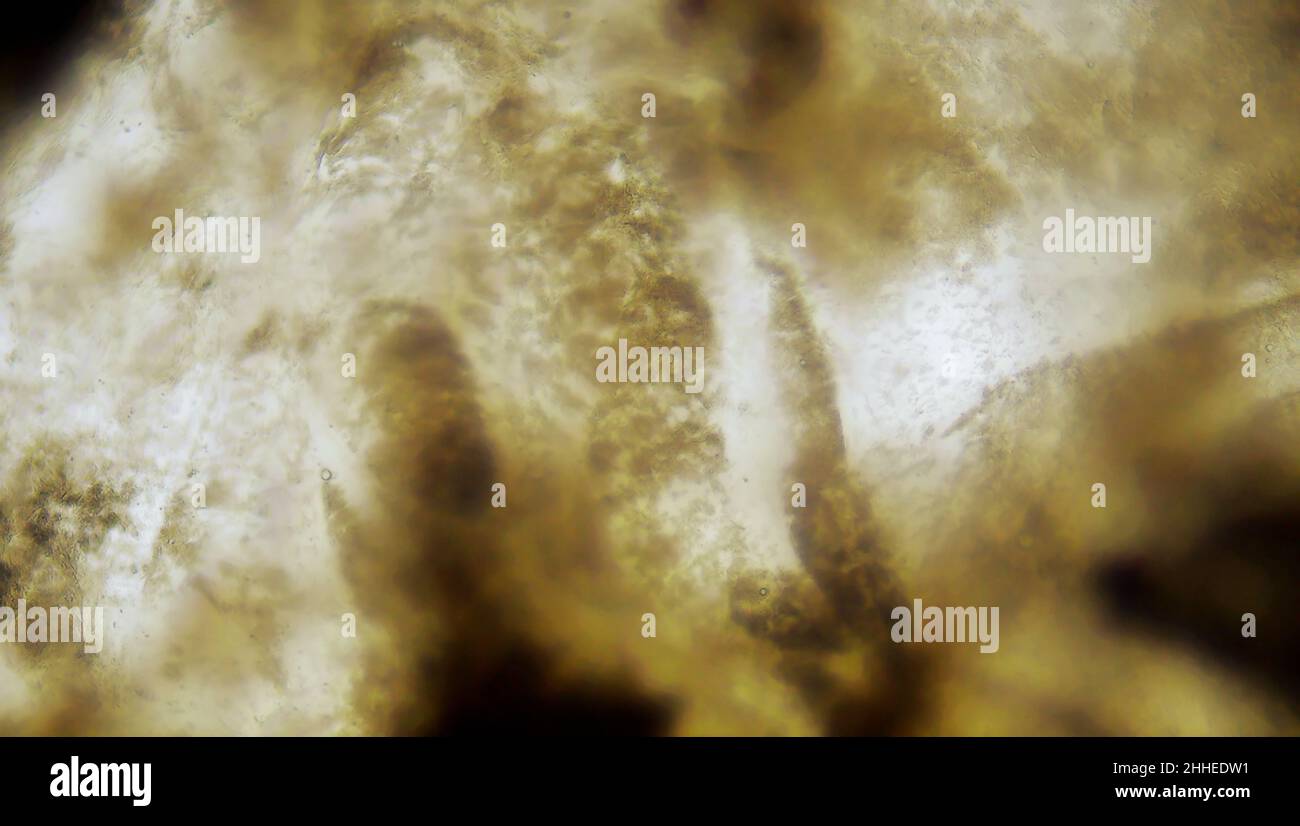 Egg yolk under the microscope Stock Photo - Alamy