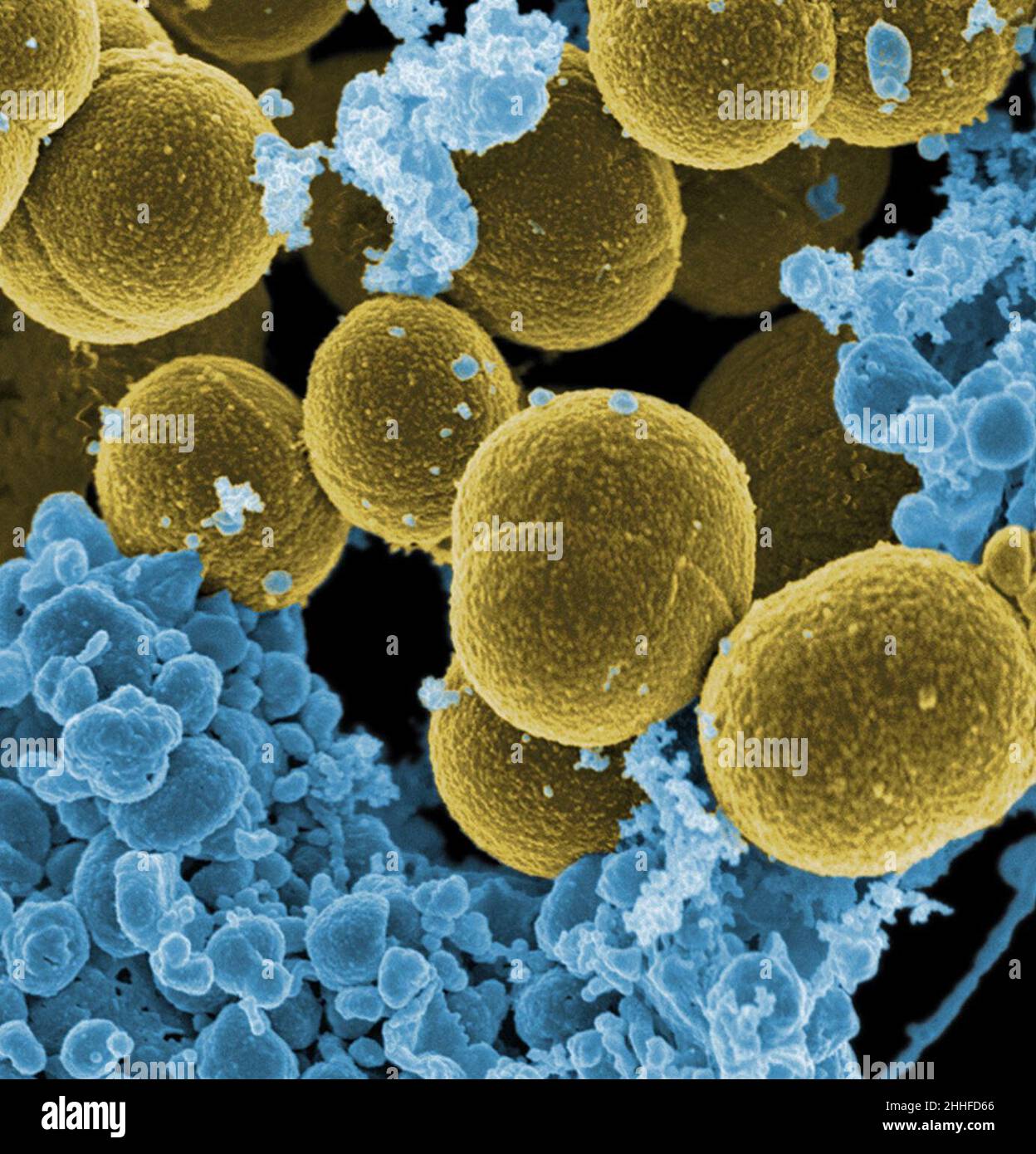 Staphylococcus aureus bacteria escape Stock Photo - Alamy