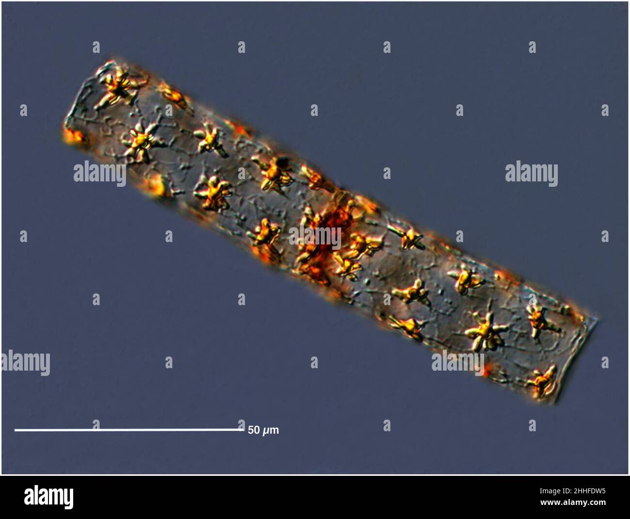 Star stick diatom Stock Photo - Alamy