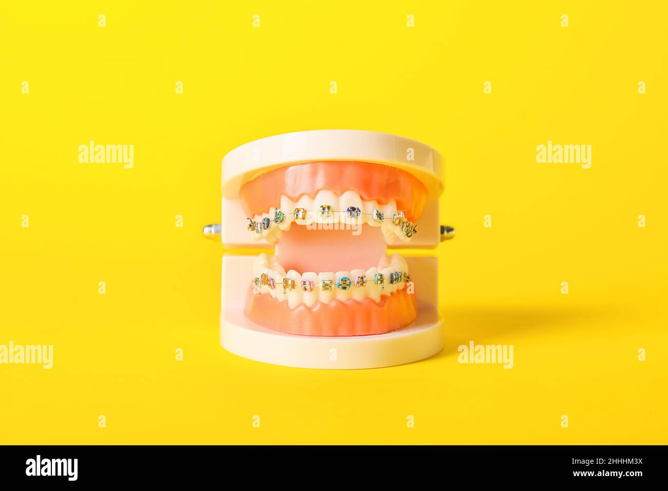 Model of jaw with braces on yellow background Stock Photo - Alamy