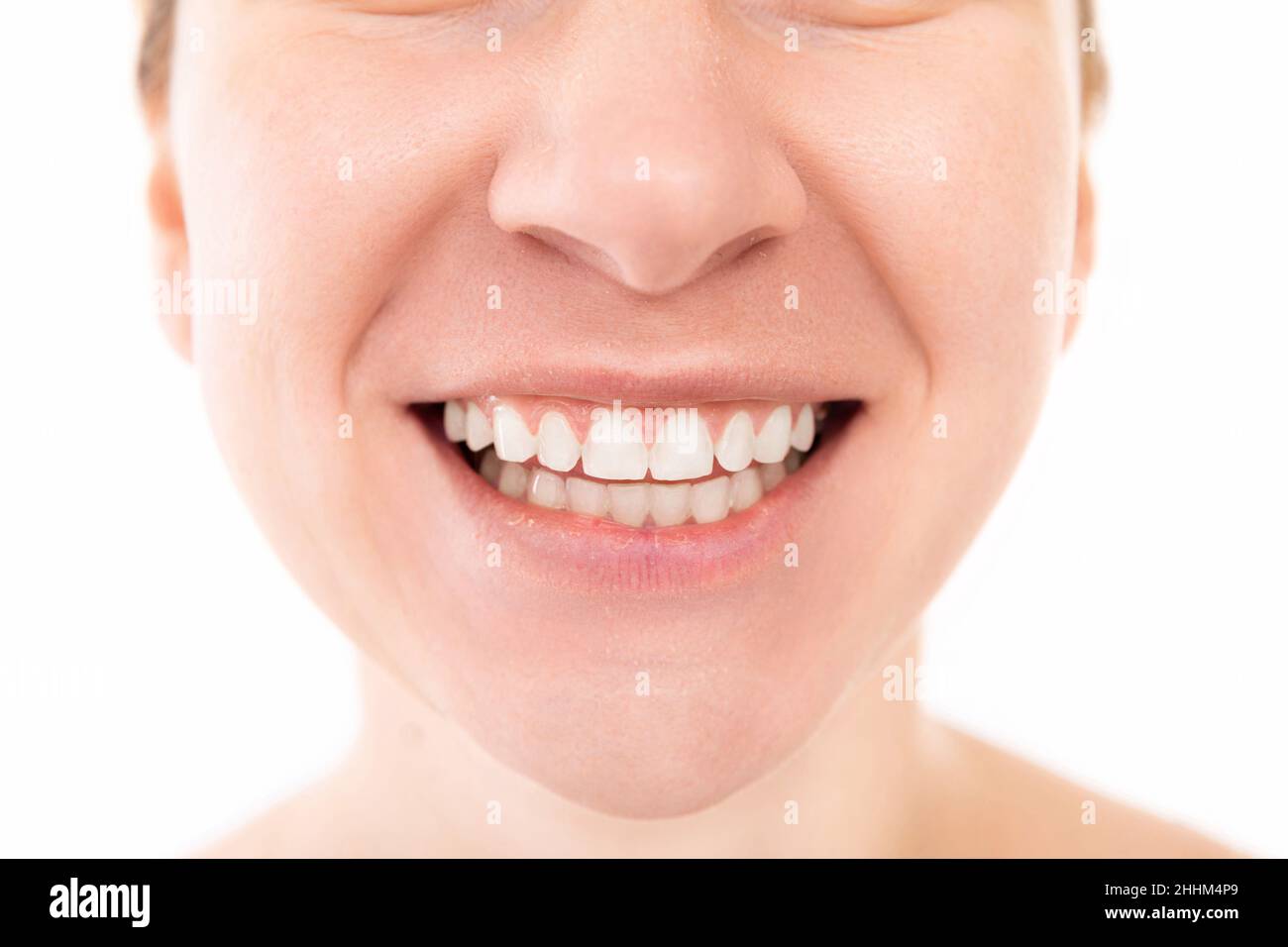 Wide smile with teeth close up, young woman portrait Stock Photo - Alamy