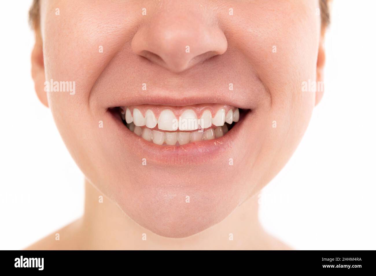 Lower half of woman face close up, smile with open mouth and white ...