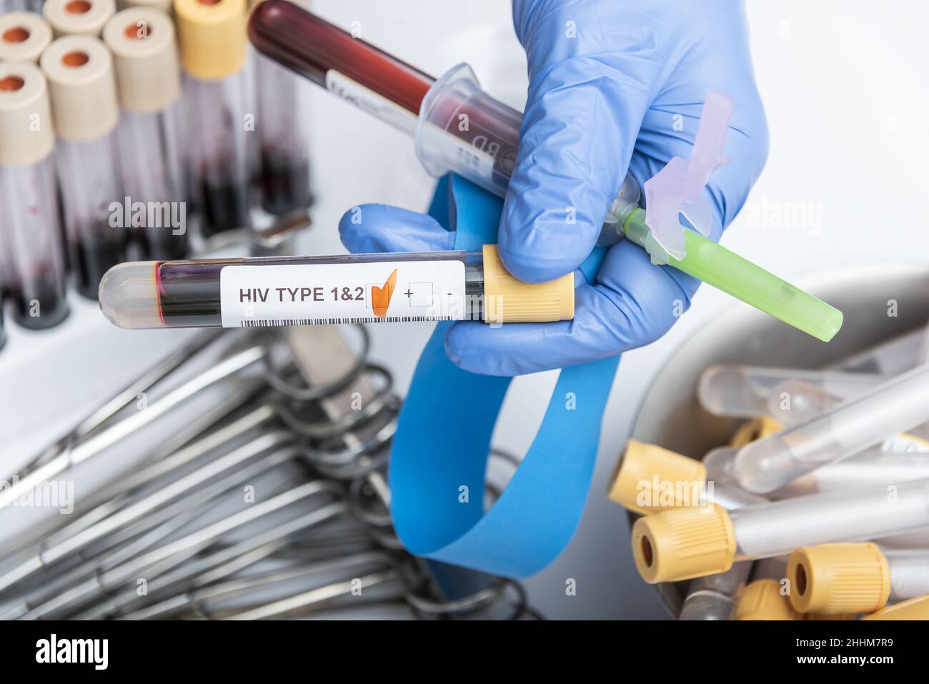 Hiv test 1 2 hi-res stock photography and images - Alamy