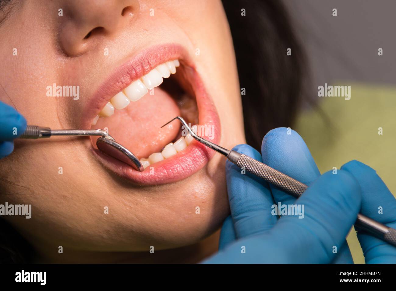 Checking teeth at the dentist Stock Photo - Alamy