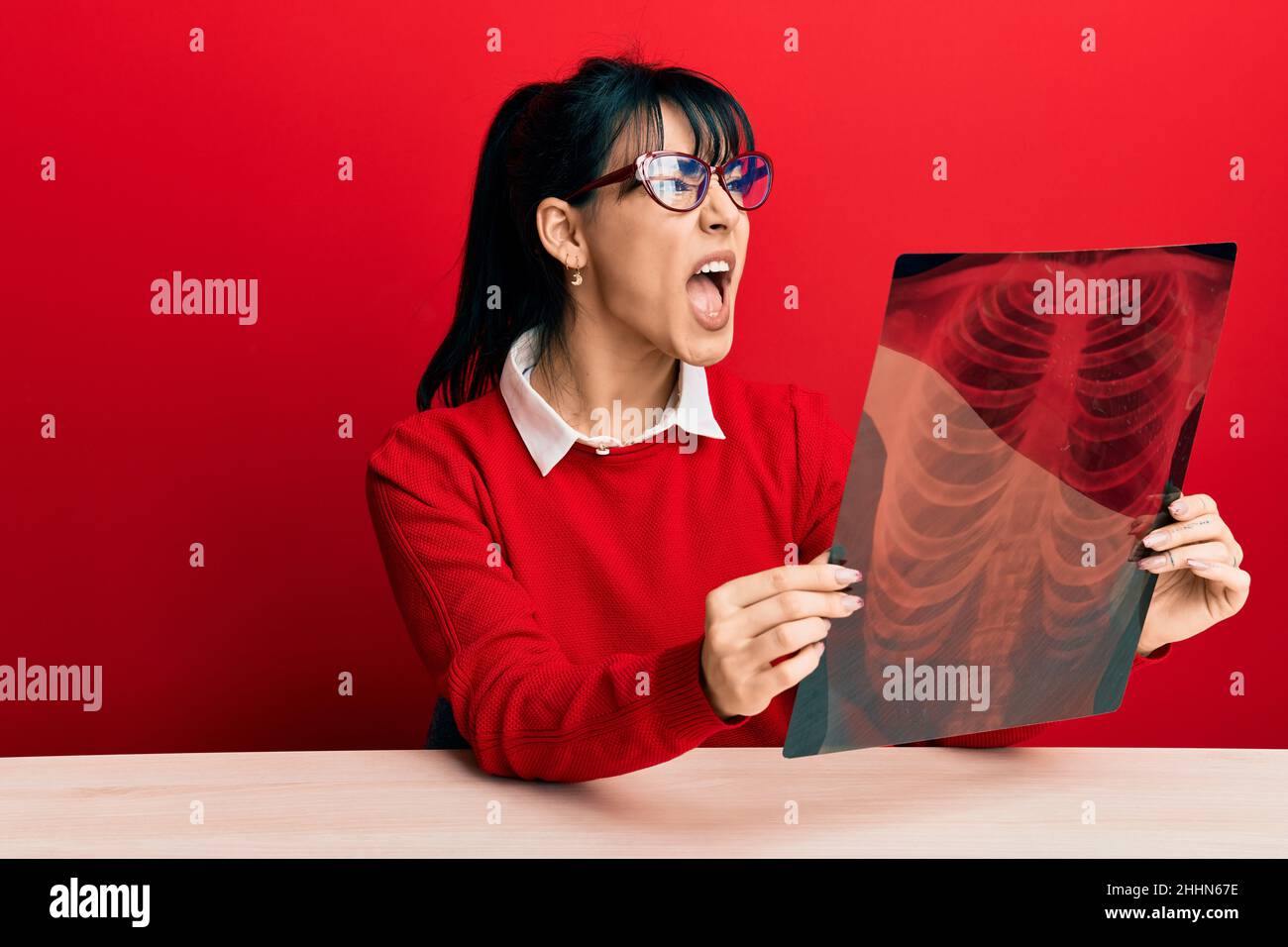 Young brunette woman with bangs holding chest radiography angry and mad ...