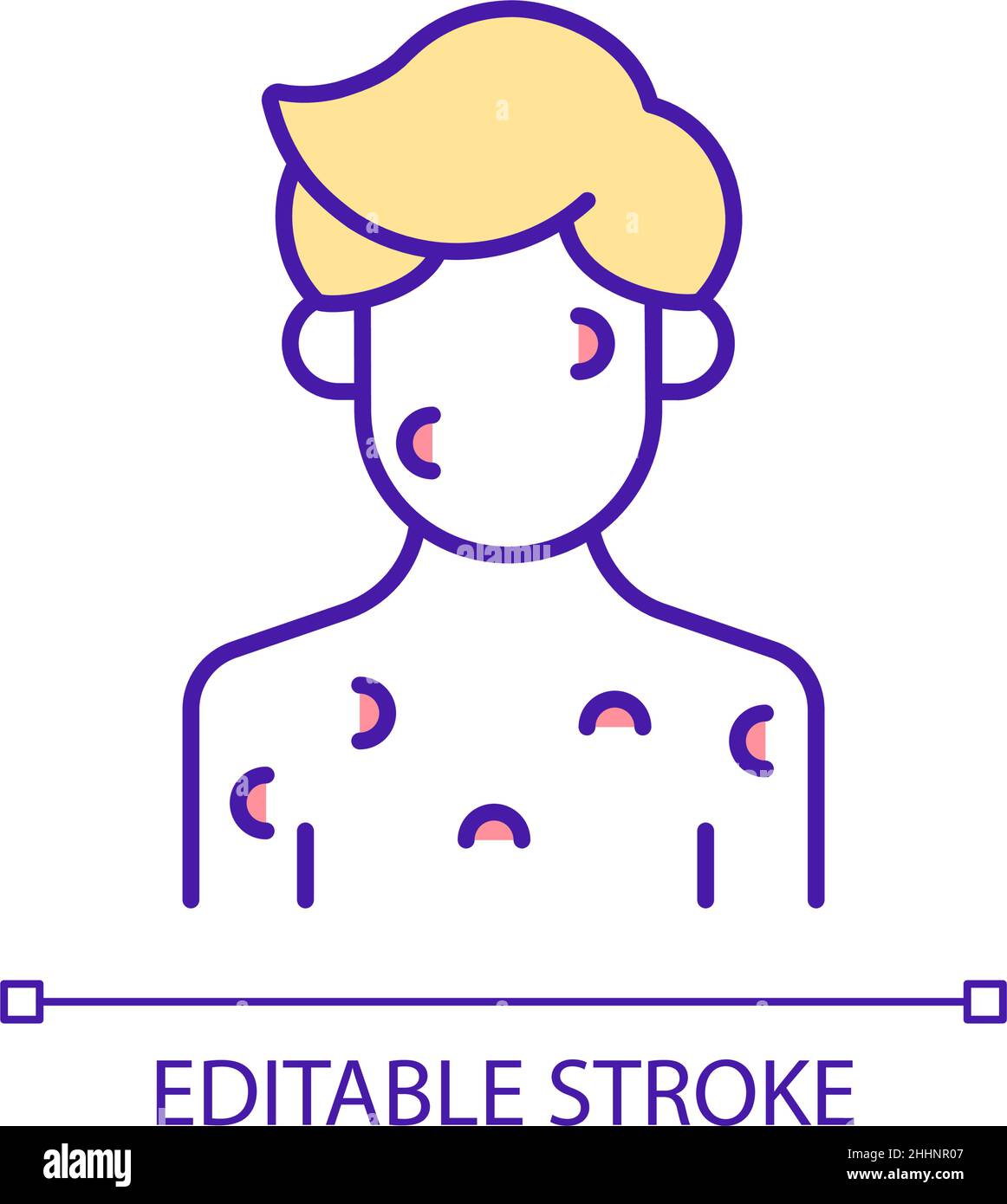 Eczema skin disease color Stock Vector Images - Alamy