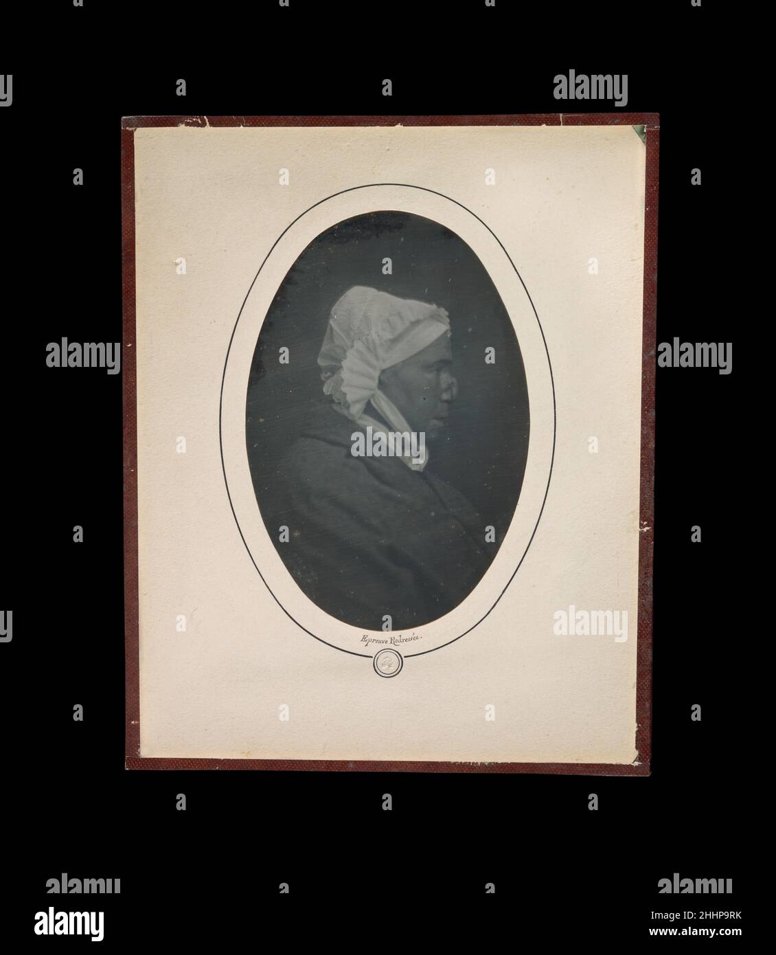 [Profile of a Woman with Necrosis of the Nose] 1841–48 Louis-Auguste ...