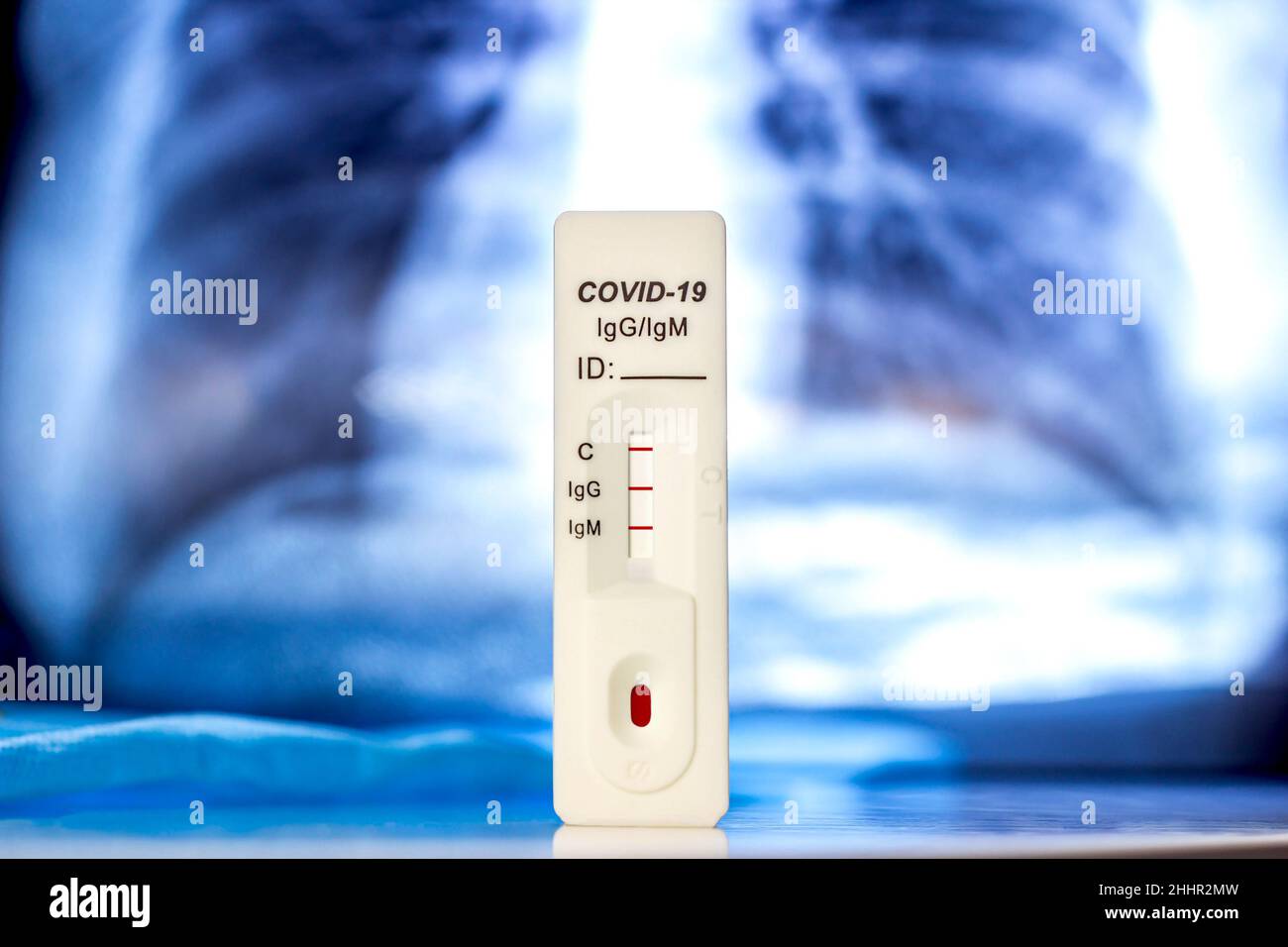 Medical covid-19 antibody and antigen positive rapid self test on blue ...