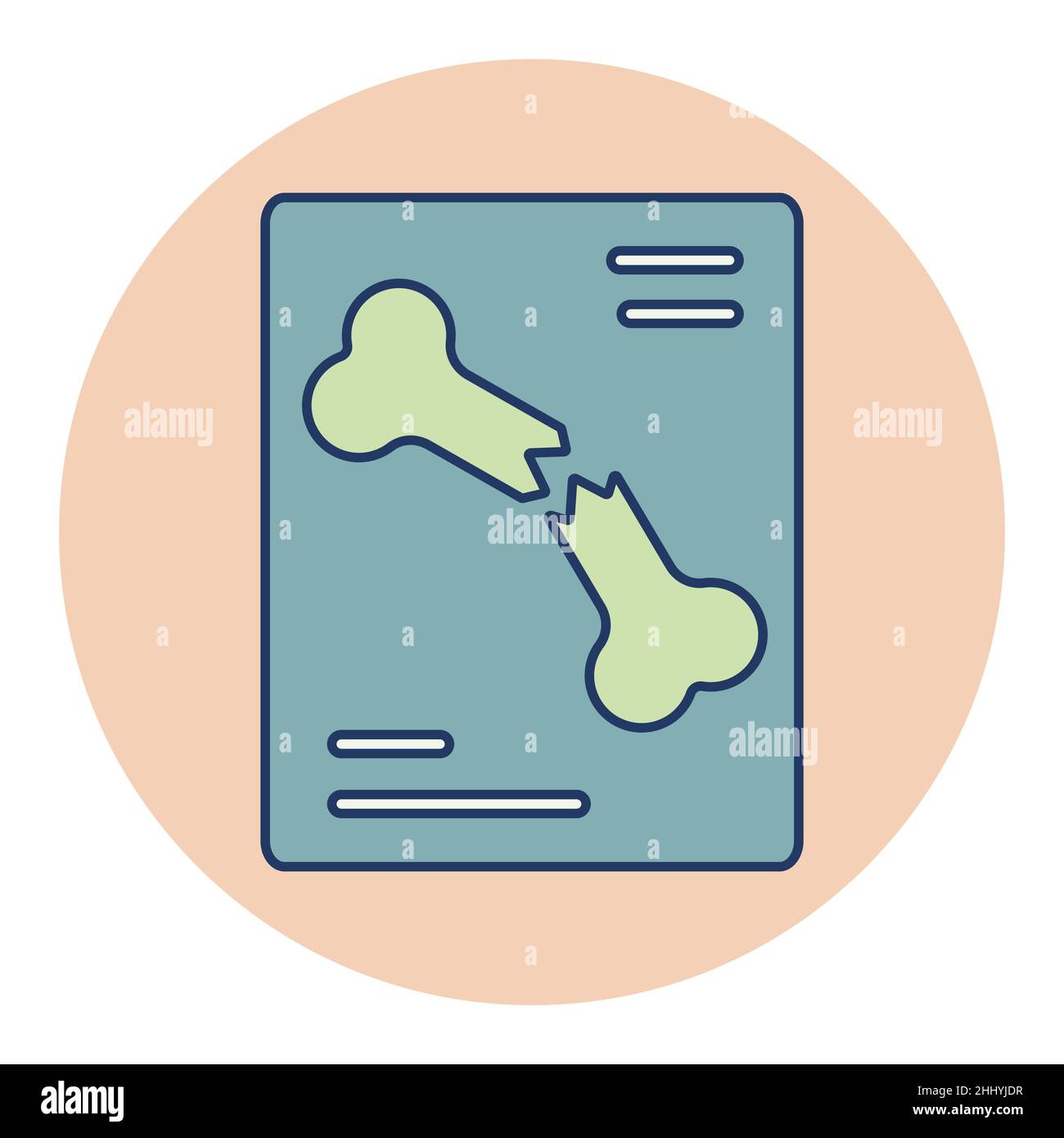 Bone fracture X-ray scan vector flat icon. Medicine and healthcare ...