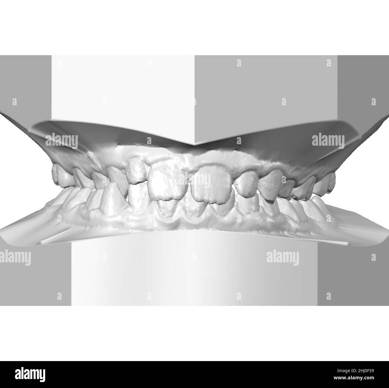 Human upper jaw 3d hi-res stock photography and images - Alamy
