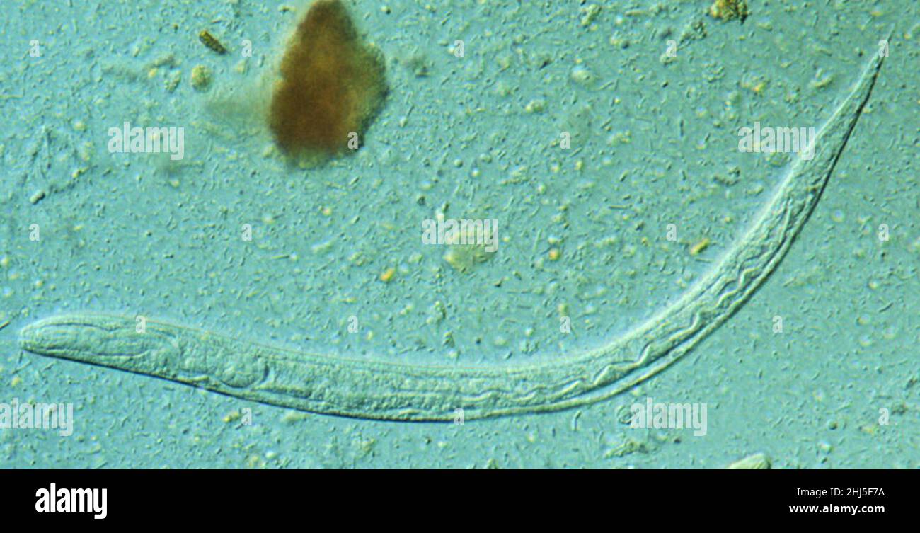 Strongyloides stercoralis larva Stock Photo - Alamy