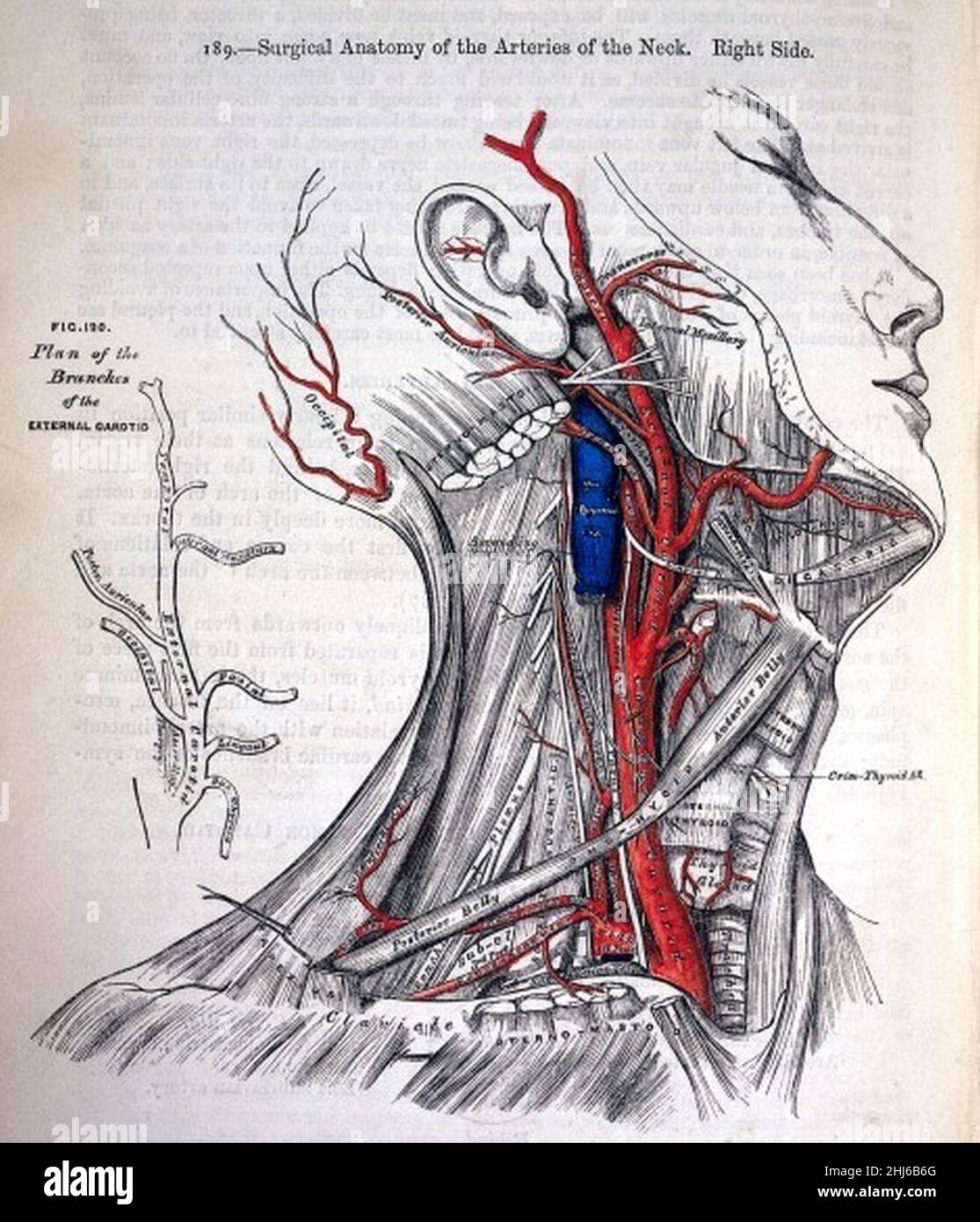 Surgical Anatomy of the Arteries of the neck Gray's Anatomy 1858 Stock ...