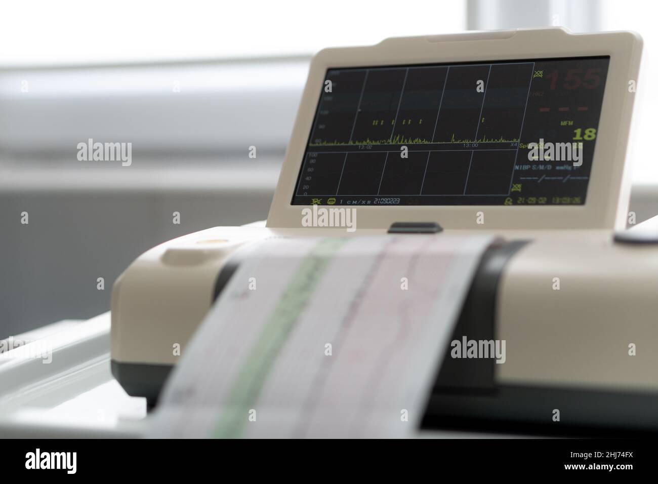 Electronic Cardiotocography Machine Monitoring Fetal Heart Contractions ...