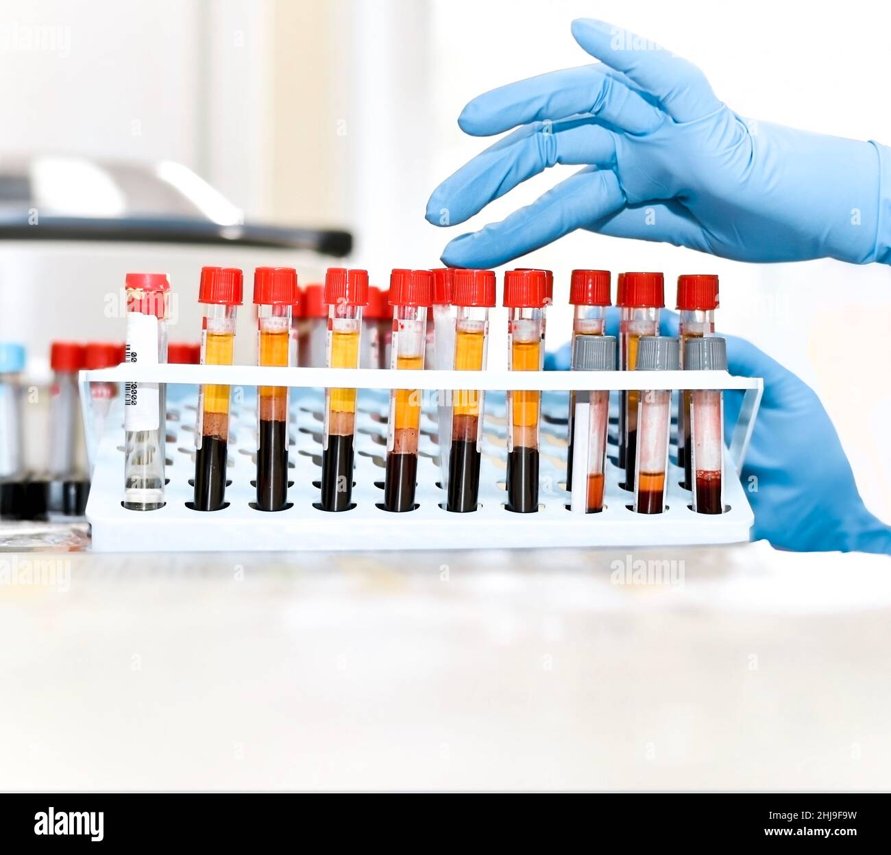 Gloved hands count the number of test tubes with biological material ...